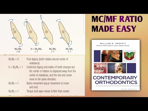 Mc/mf ratio in orthodontics |moment to force ratio| biomechanics ...