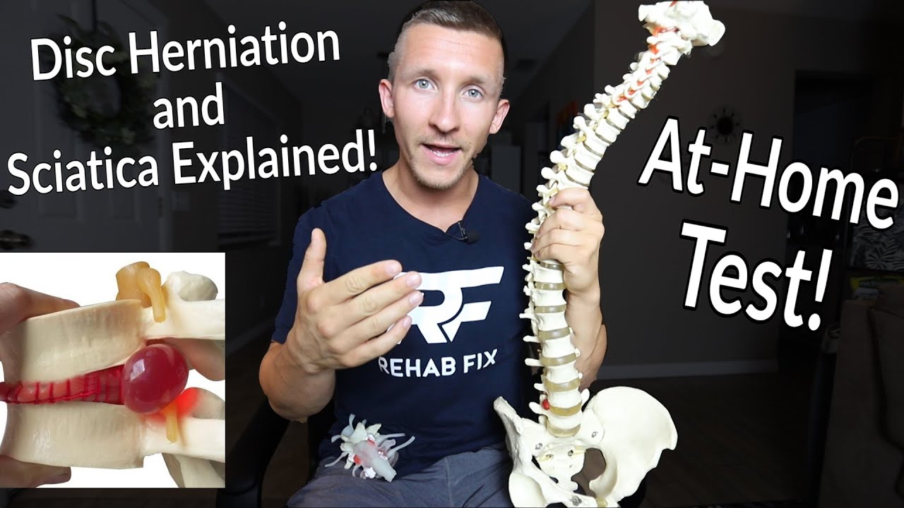 Disc Herniation and Sciatica Explained | Why Bending Forward HURTS! - YouTube