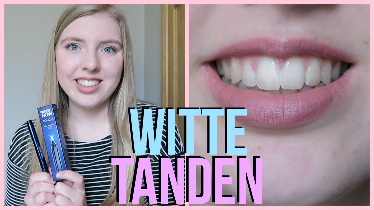 WITTERE TANDEN IN 1 MINUUT / Signal White Now Touch - YouTube