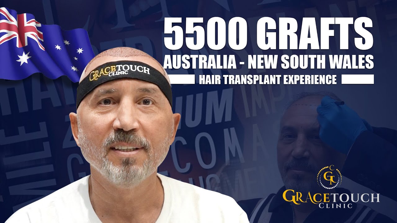 Hair Transplant Journey in Istanbul, Turkey at Grace Touch Clinic - YouTube