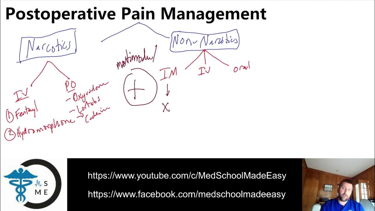 Postoperative Pain Options (VERY BASIC INFORMATION) made easy! - YouTube