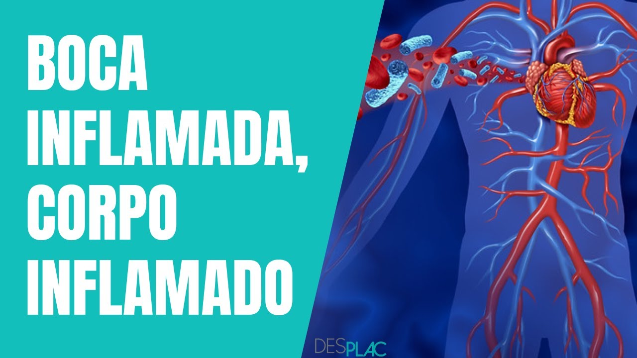 BOCA INFLAMADA, CORPO INFLAMADO - YouTube