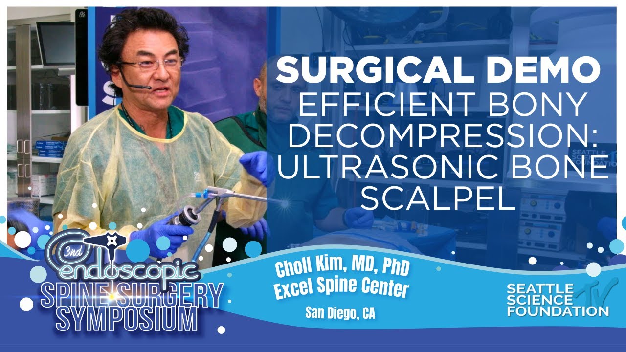 Surgical Demo: Efficient Bony Decompression - Ultrasonic Bone Scalpel ...