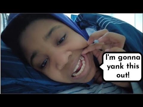 Loose Tooth