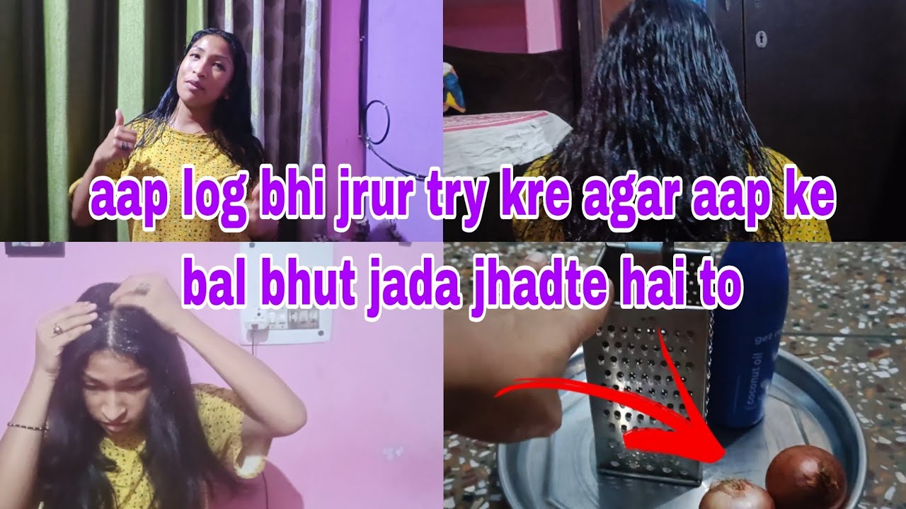 aap log bhi jrur try kre agar aap ke bal bhut jada jhadte hai to ...