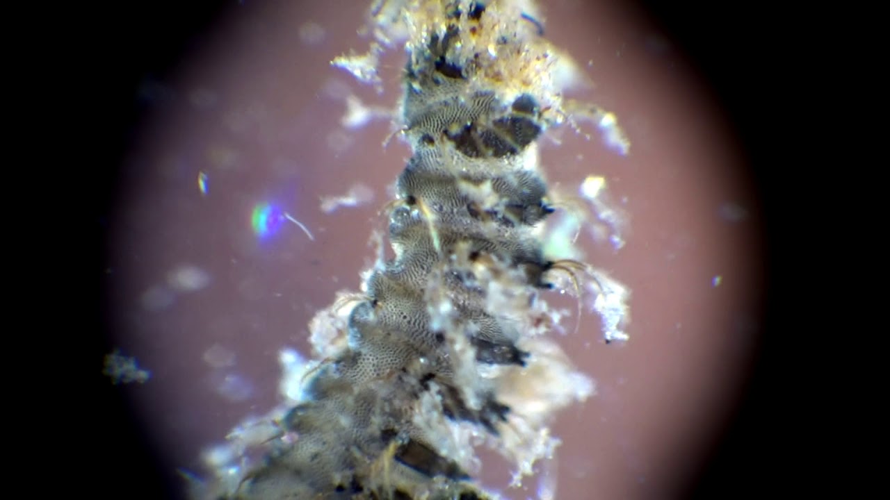 Psychodidae Larvae