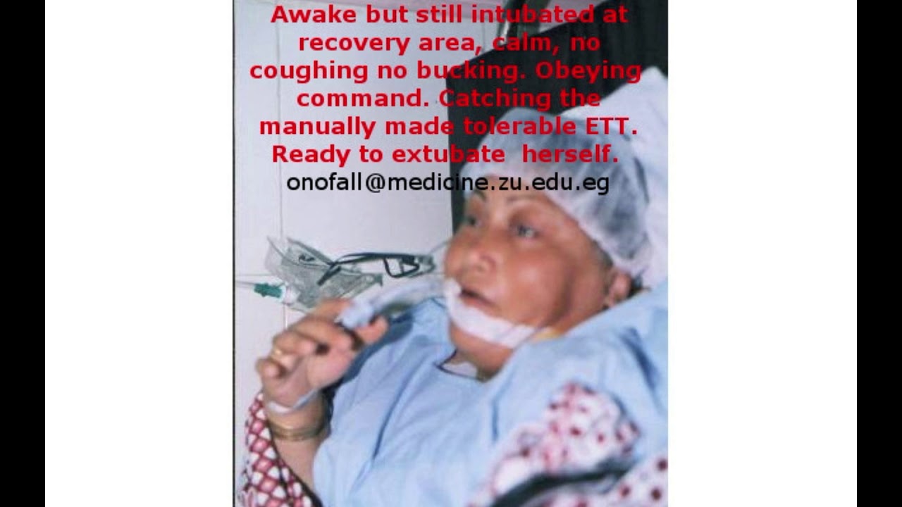 Awake extubation T E T recovery area 1 - YouTube