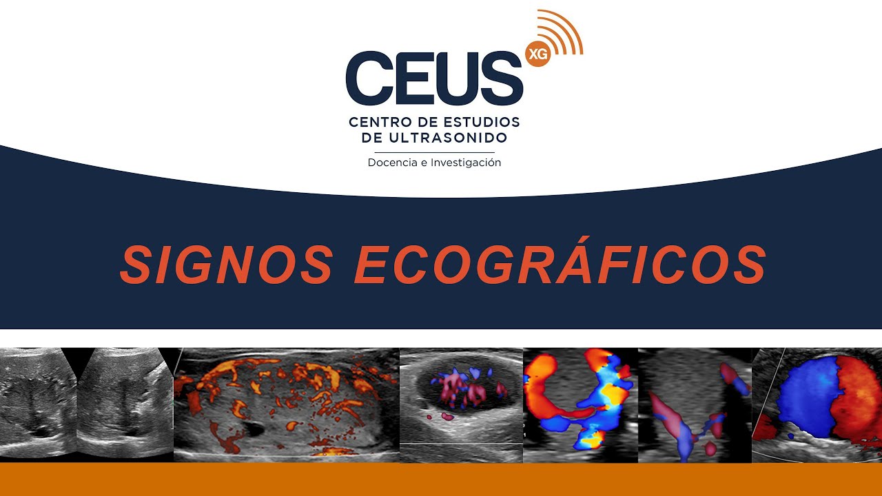 SIGNO ECOGRÁFICO N° 01: LAMBDA. - YouTube