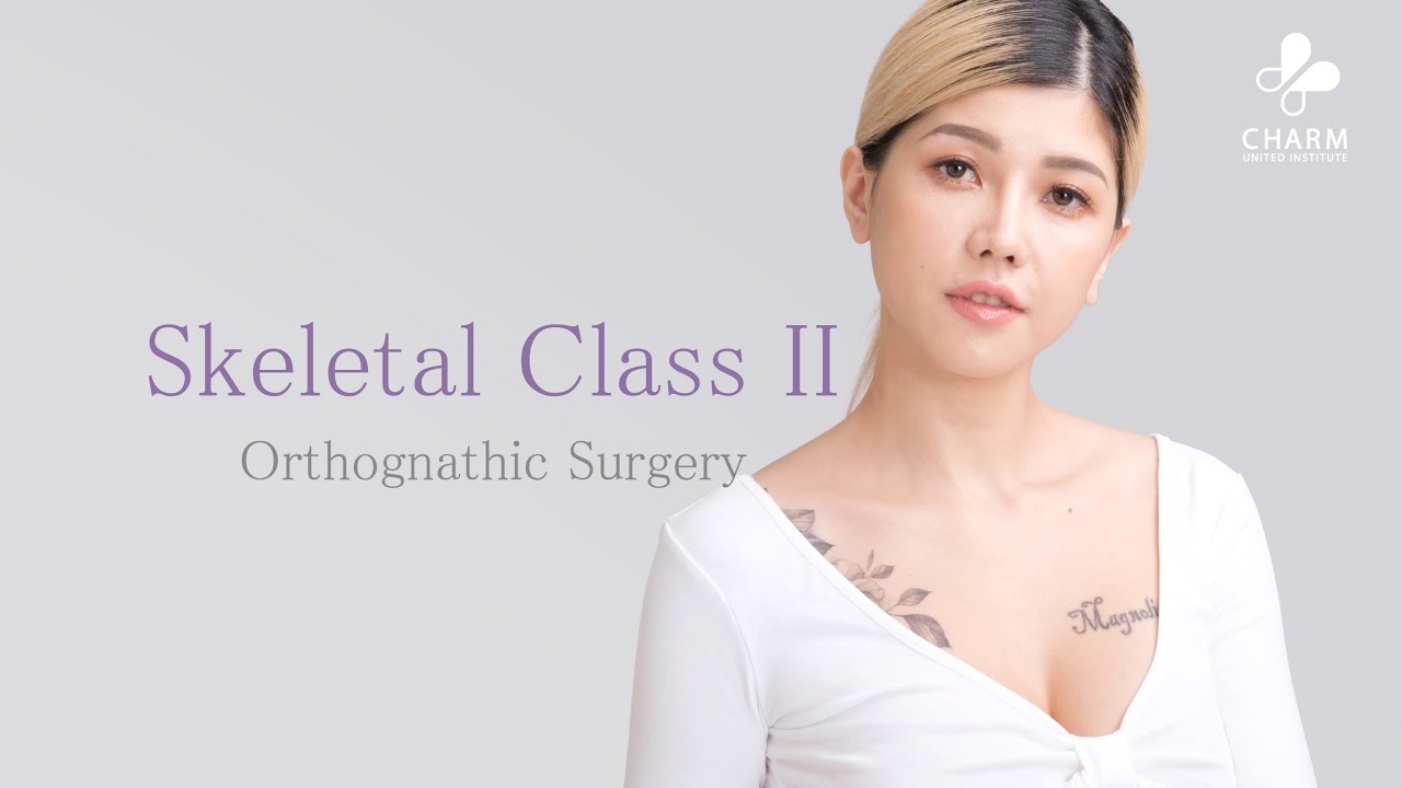 Skeletal Class II Orthognathic Surgery - YouTube