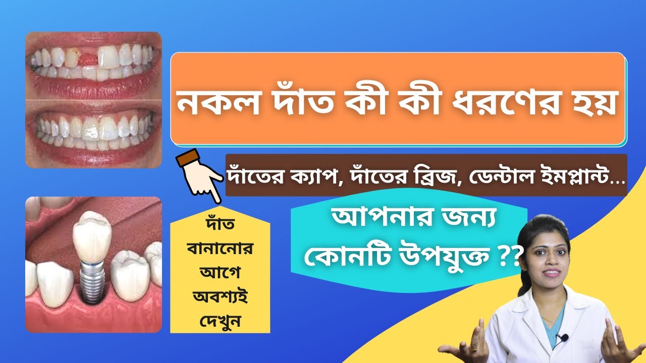 নকল দাঁত | কৃত্রিম দাঁত | দাঁতের ক্যাপ | দাঁতের ইমপ্লান্ট | Artificial ...