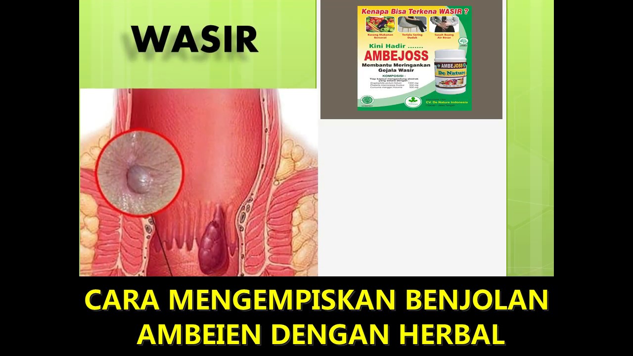 CARA MENGEMPISKAN BENJOLAN AMBEIEN DENGAN HERBAL - YouTube