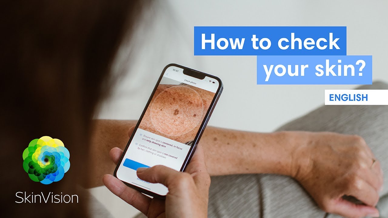 Checking your skin for the risk of skin cancer? Here's how! - YouTube