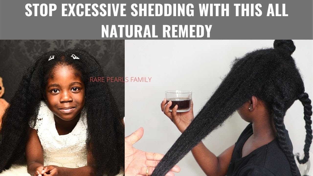 STOP Excessive Shedding With This All Natural Remedy | Only 2 ...