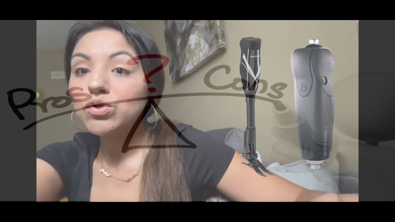 Prosthetic Leg Pros and Cons - YouTube
