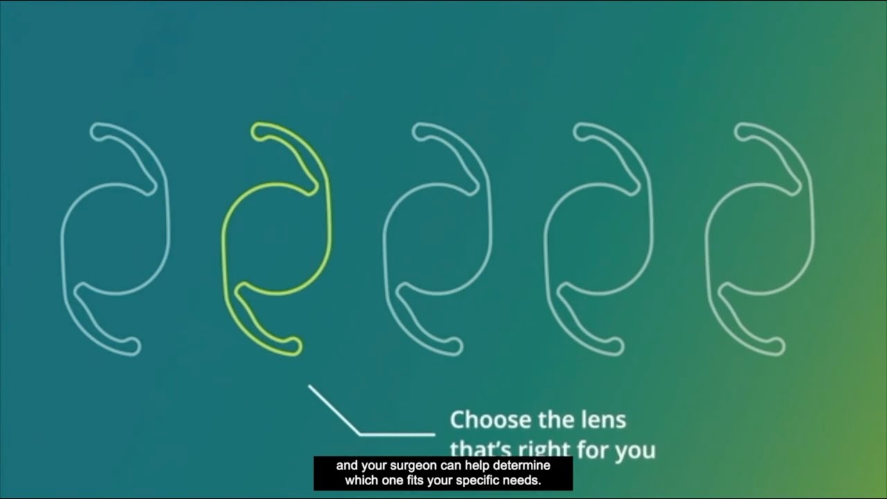 Your Cataract Lens Replacement Options - YouTube