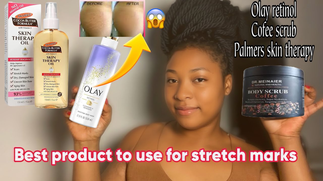 BEST EFFECTIVE PRODUCT 2 HELP GET RID OF STRETCH MARKS🌟|| LIGHTNING AND ...