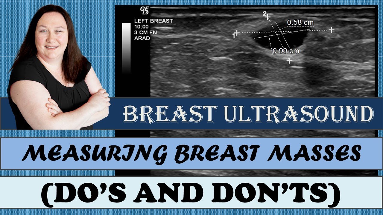 Breast Ultrasound Measuring Breast Masses Do s Don ts Registry