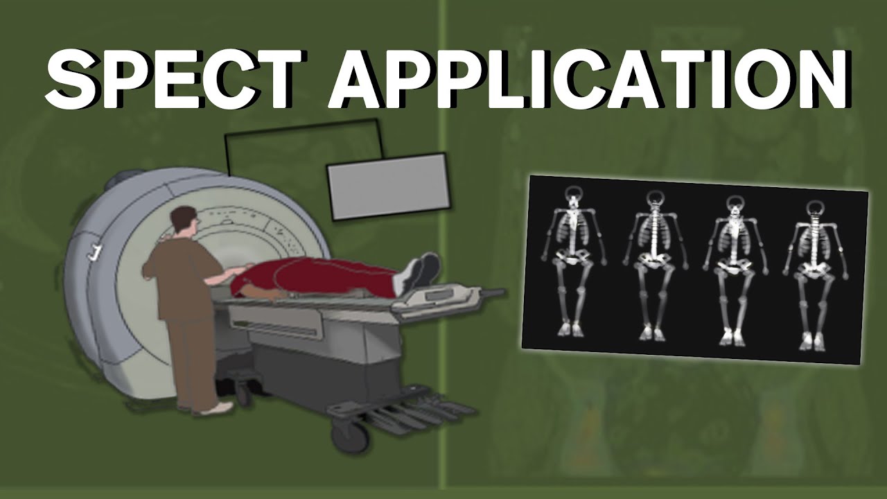 SPECT - YouTube