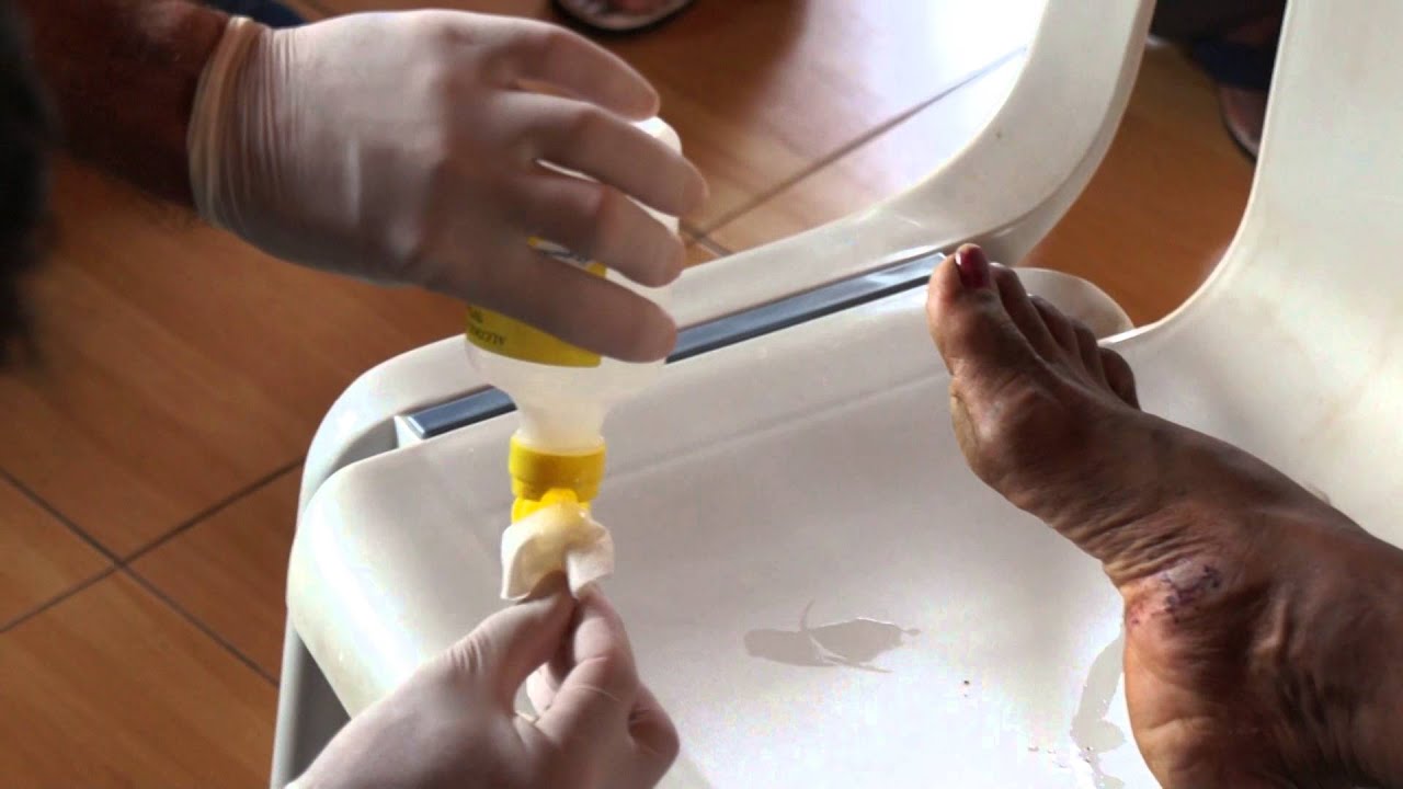 Video 17 Plaies simples 1 - YouTube