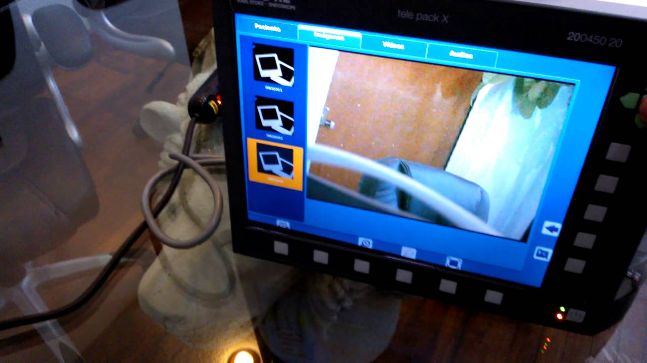 telepack X STORZ - YouTube