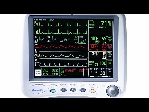 Cardiac Monitor... A Brief Description - YouTube