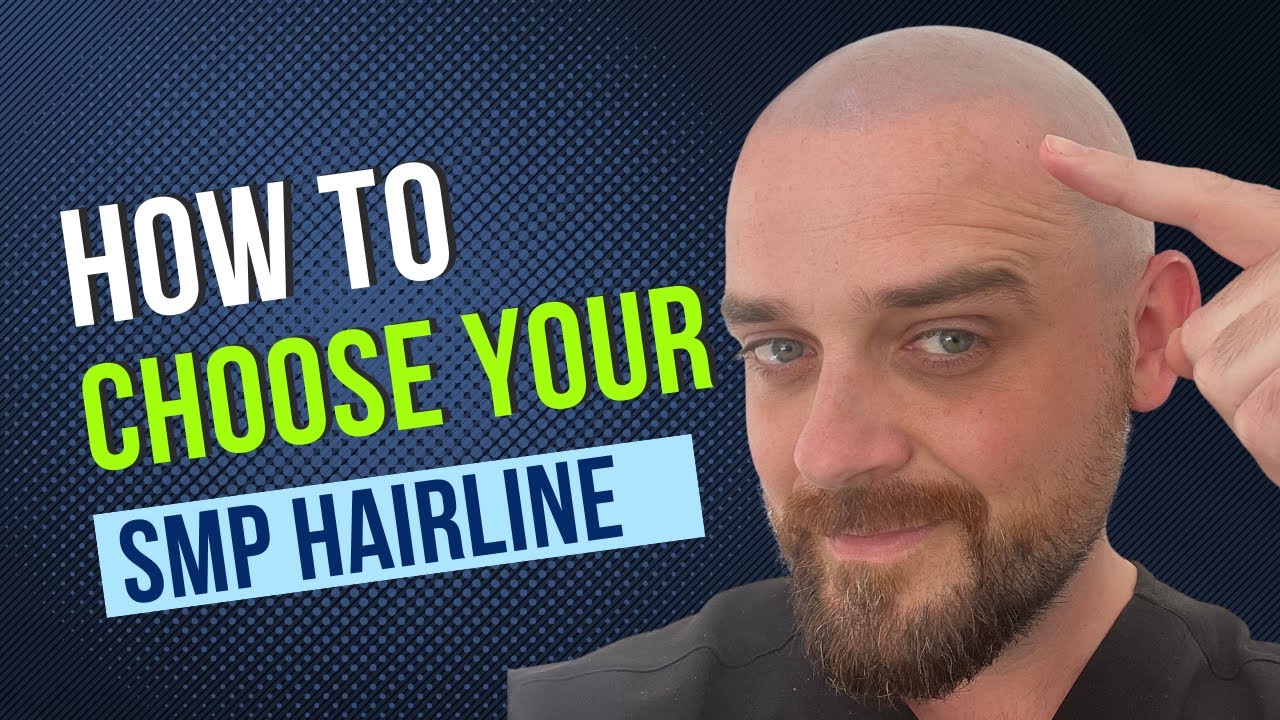 Which SMP hairline is right for you? - YouTube