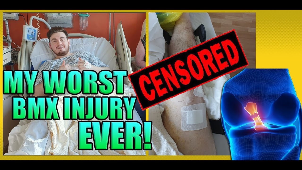 My WORST BMX Injury Ever! ACL & Meniscus RECONSTRUCTION Surgery ...