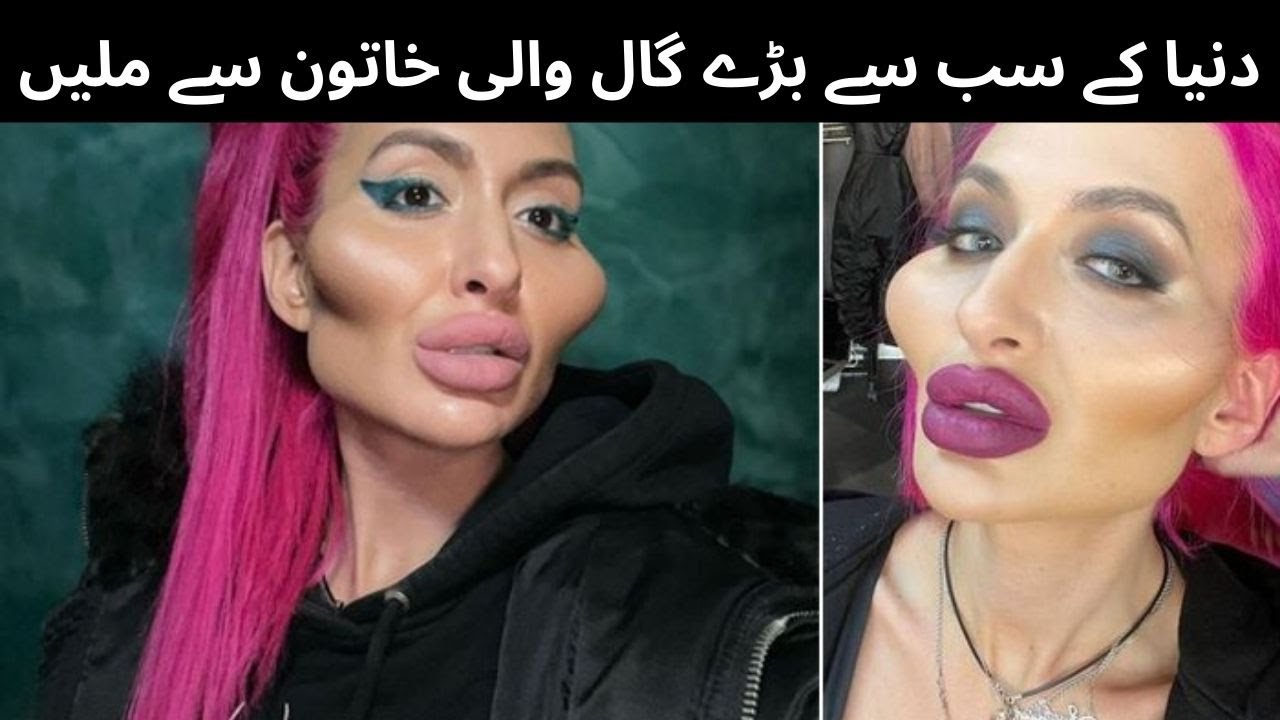 Meet the woman with the biggest cheeks in the world | Biggest Cheeks ...