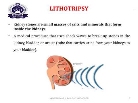 lithotripsy Simple Explanation - YouTube