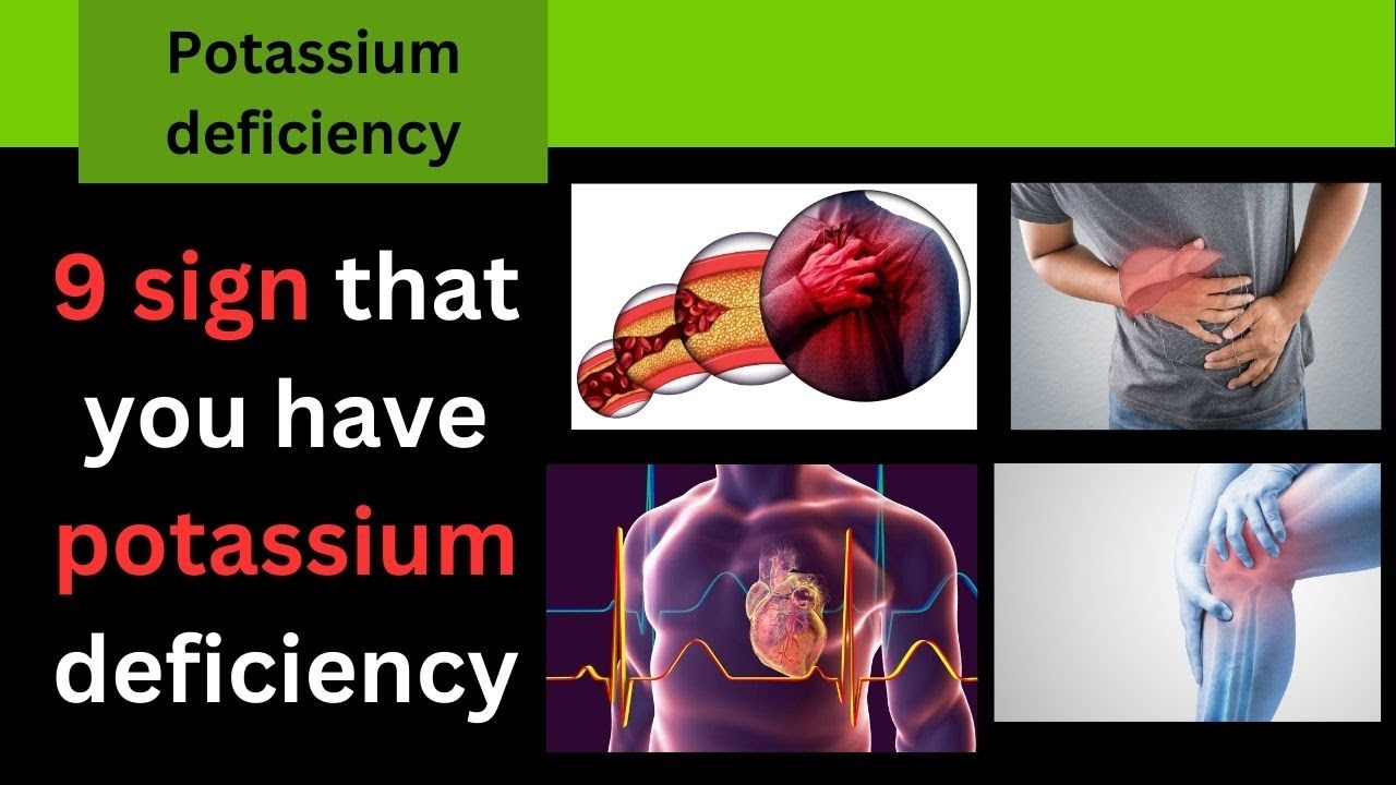 9 Signs You Have Potassium Deficiency||Symptoms, Causes, and Treatment ...