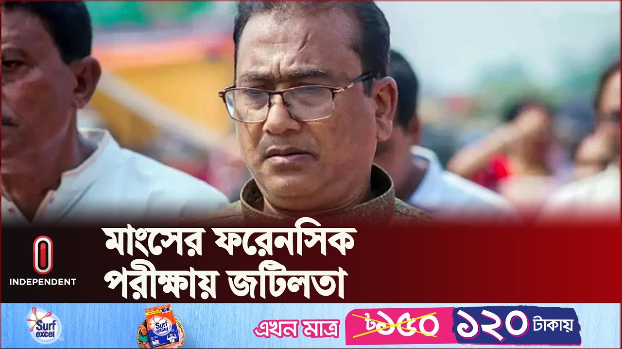 মাংসের ফরেনসিক পরীক্ষায় নিশ্চিত ফল পাওয়া নিয়ে সংশয়ে || Anwarul Azim ...