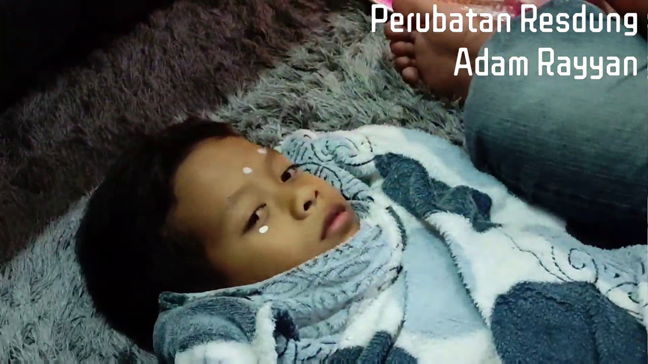 Perubatan Resdung Adam Rayyan - YouTube