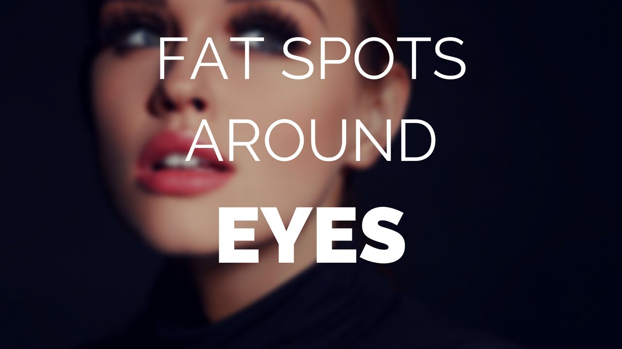 Fat spots around eyes and how to easily remove them. - YouTube