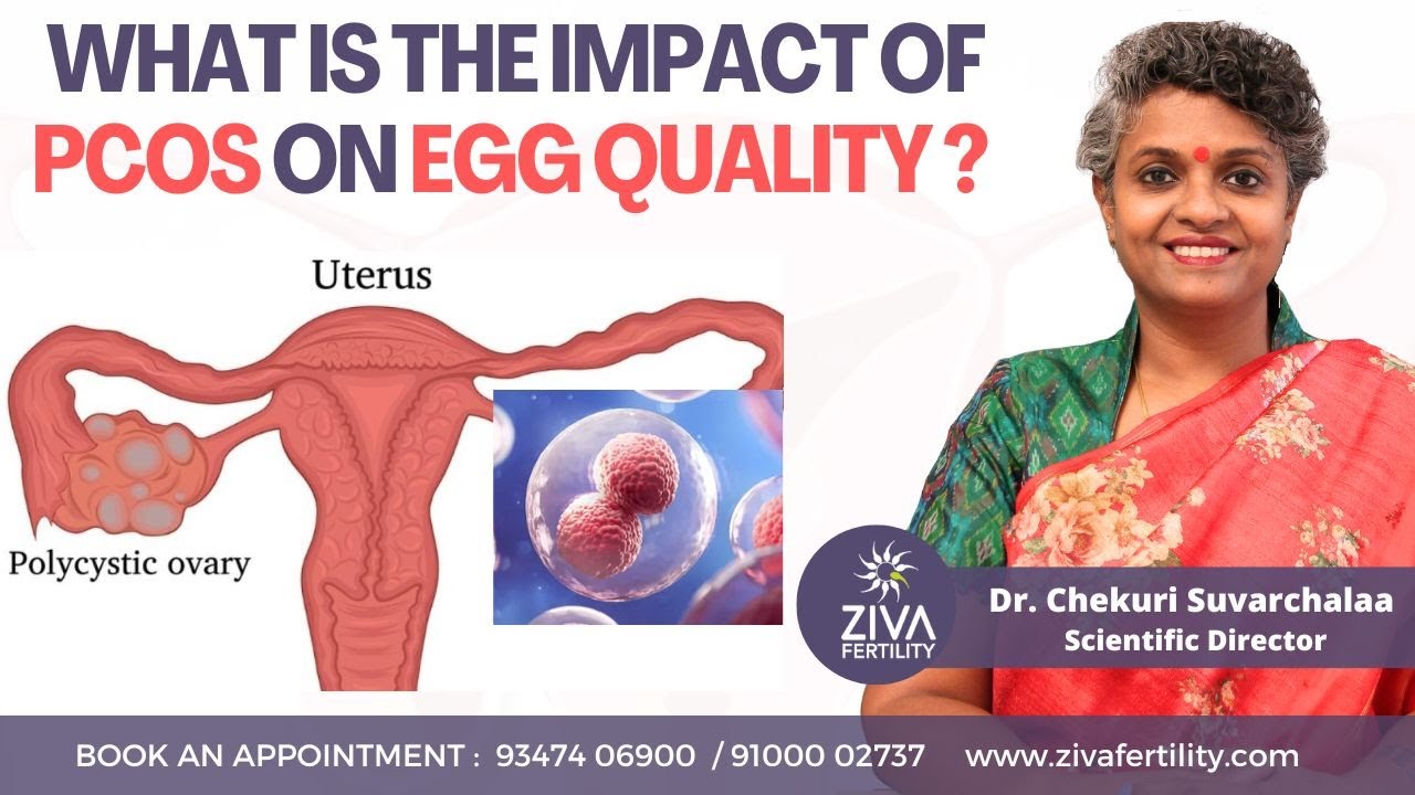 Impact of PCOS On Egg Quality || Fertility || Dr C Suvarchalaa || ZIVA ...