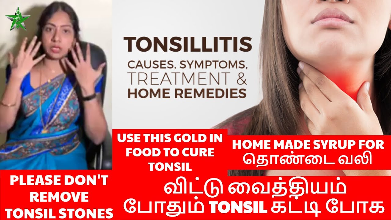 Tonsil Stones | Home Made Syrup for தொண்டை வலி | Asha Lenin - YouTube