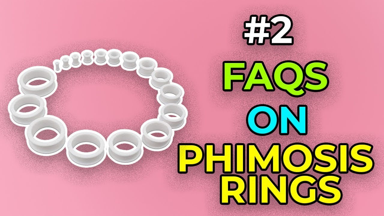 #2 Frequently Asked Questions on Phimosis Rings - YouTube
