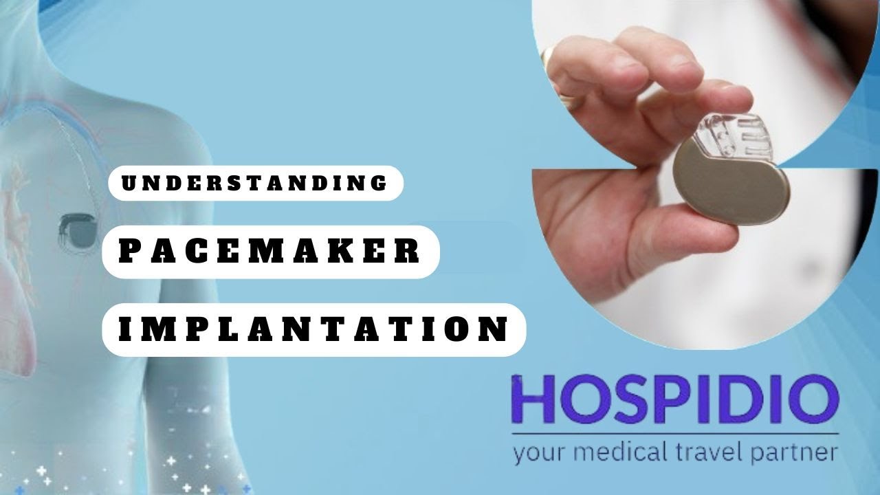 Understanding Pacemaker Implantation- A Simple Guide | HOSPIDIO - YouTube