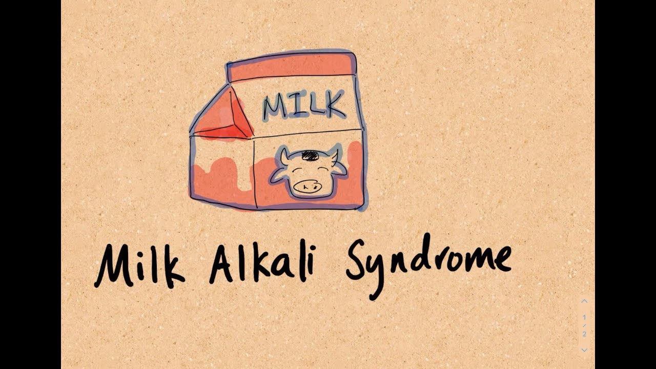 Milk Alkali Syndrome - YouTube