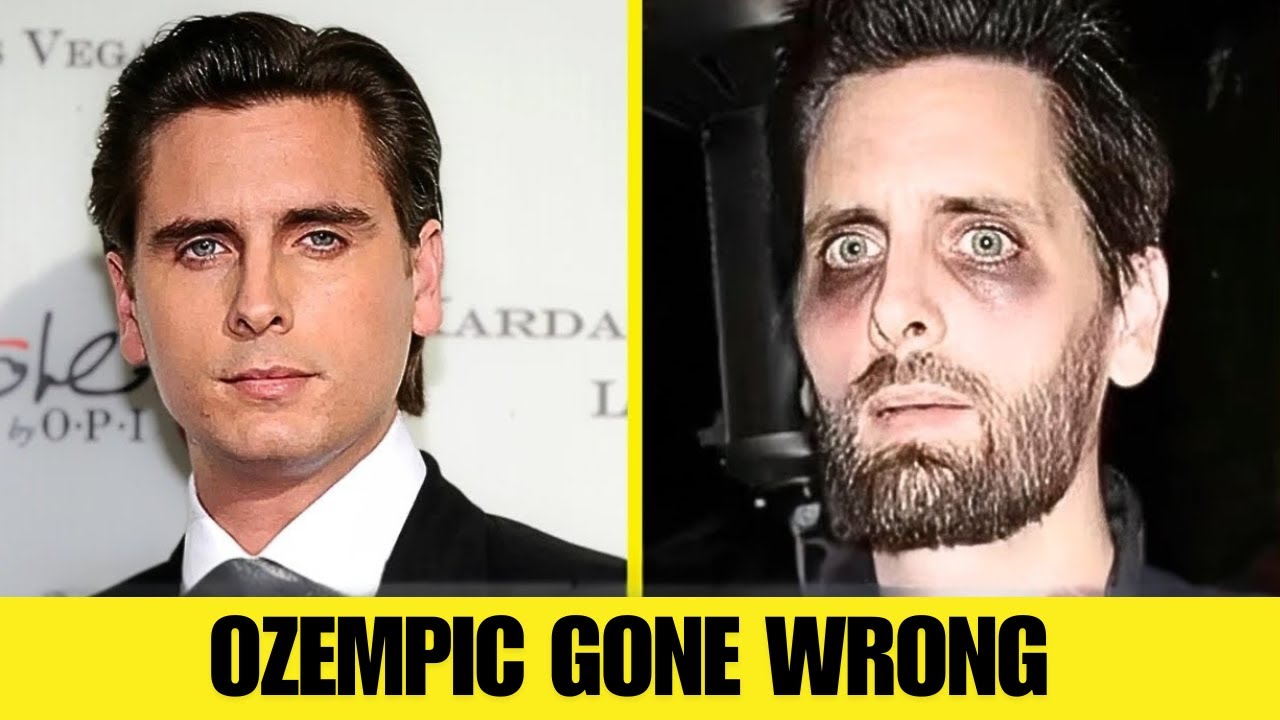 10 Celebs With Shocking Ozempic Face Transformations | Then and Now ...