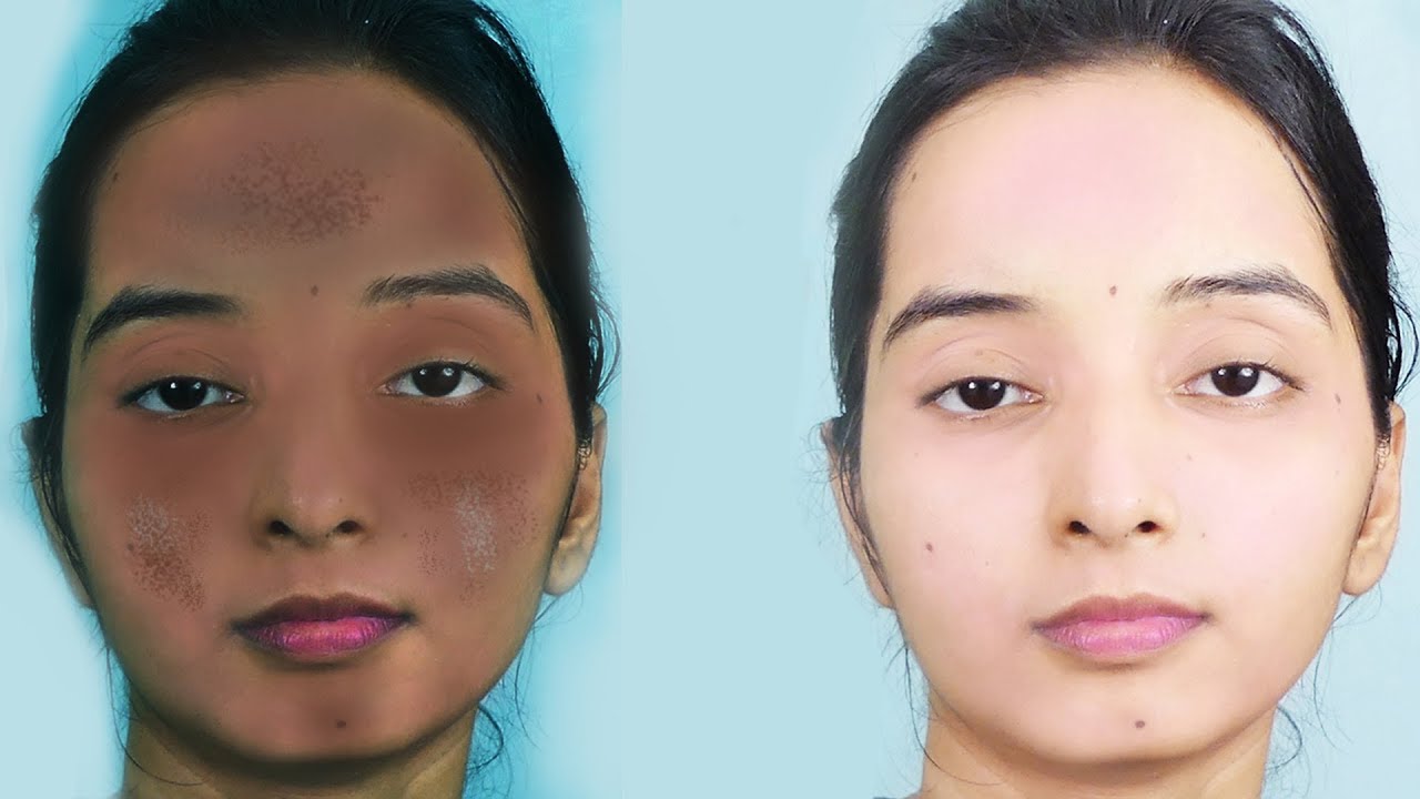 1 ही बार में चेहरे का कालापन हटाकर इतना गोरा और खूबसूरत बना देगा ये ...