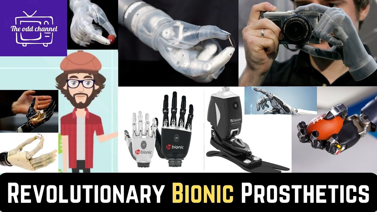 Revolutionary Bionic Prosthetics: Changing Lives One Limb at a Time ...