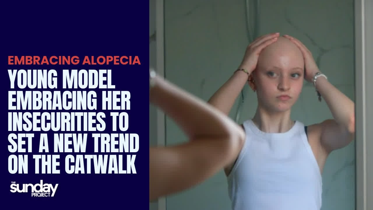 Young Model Embracing Alopecia To Set A New Trend On The Catwalk - YouTube