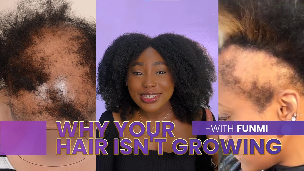 Why Isn't My Hair Growing? | Tips & Best Hair Oils for Faster Hair ...