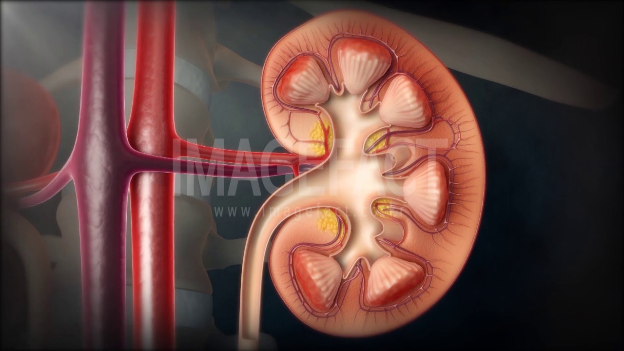 kidney disease | reflux nephritis - YouTube