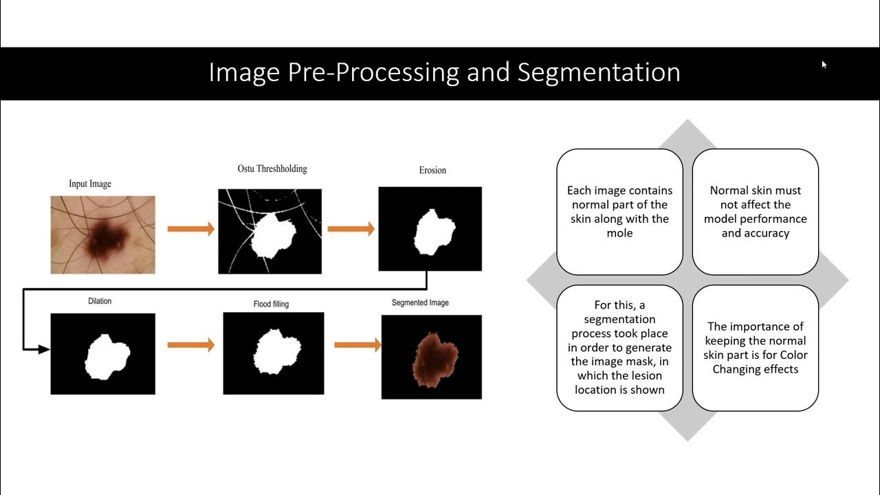 A Machine learning based Melanoma Skin cancer classification using ...