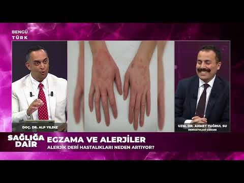 Egzema ve Alerjiler - Sağlığa Dair | 12 Temmuz 2025