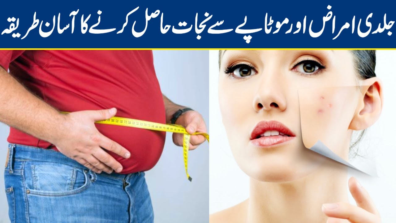 Easy Treatment of skin diseases and obesity | Jaago Lahore - YouTube