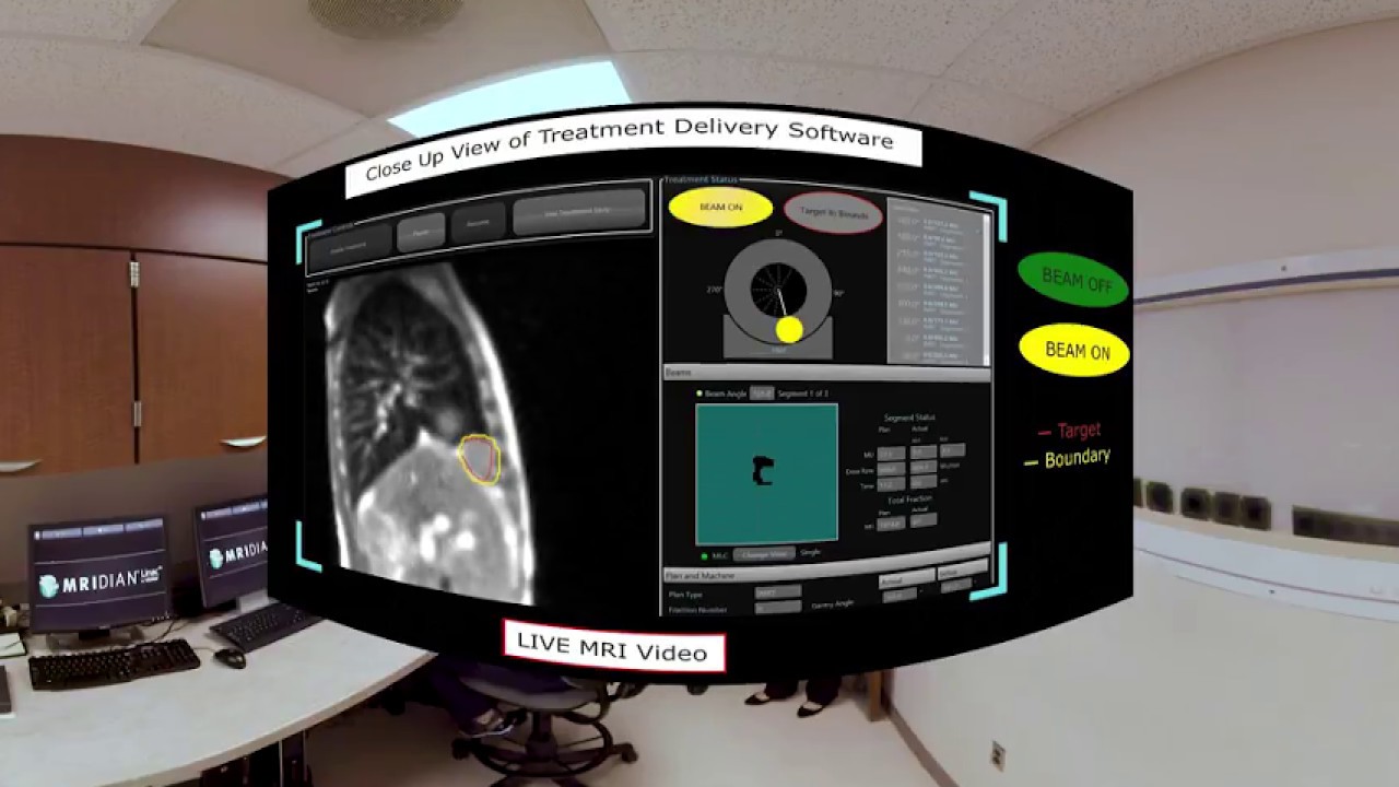 Part 3/3 - Intro to ViewRay MRIdian MR image guided Radiation Treatment ...