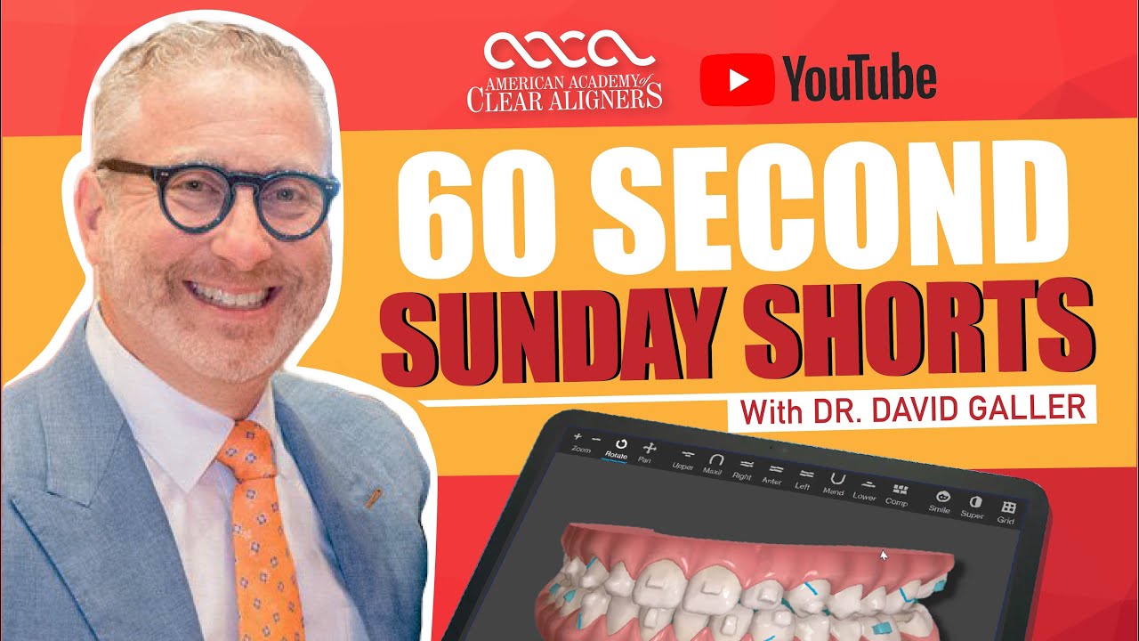 Active and Passive Aligners - YouTube