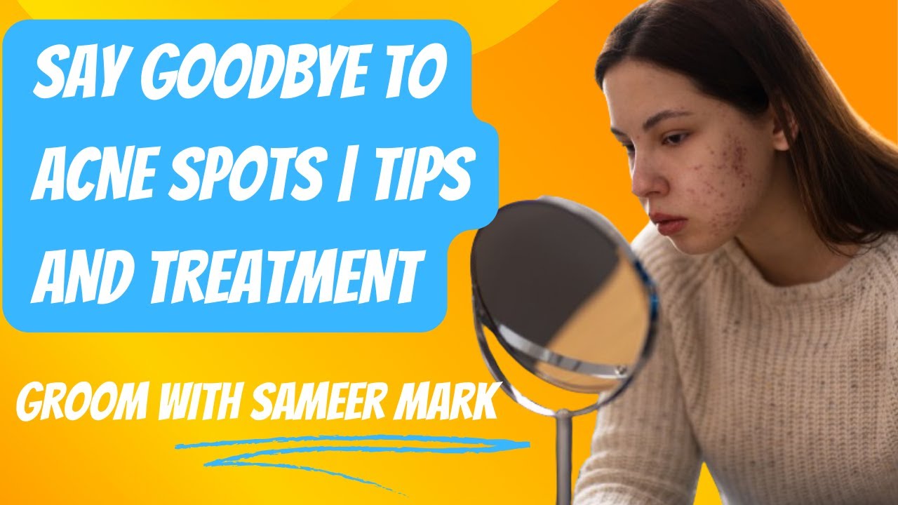 SAY GOODBYE TO ACNE SPOTS | TIPS AND TREATMENT - YouTube